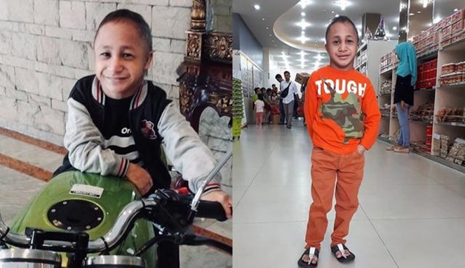 Kenali Sejak Dini Gejala Pembengkakan Jantung yang Diderita Dicky Topan ...